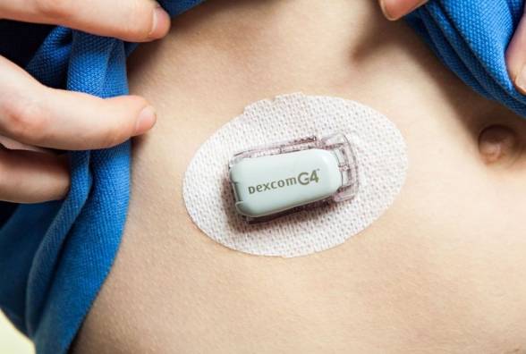 Обзор Dexcom G4 – системы непрерывного мониторинга глюкозы. Тонкости ...